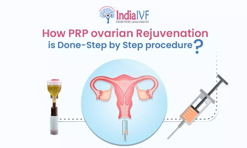 PRP Ovarian Rejuvenation: Step-by-Step Procedure at India IVF Fertility