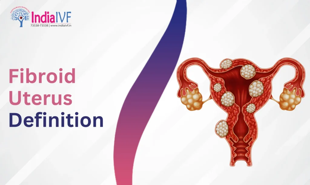 Fibroid Uterus Definition - Understanding the Condition