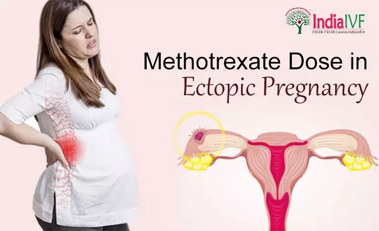 Methotrexate Dose in Ectopic Pregnancy - India IVF Fertility
